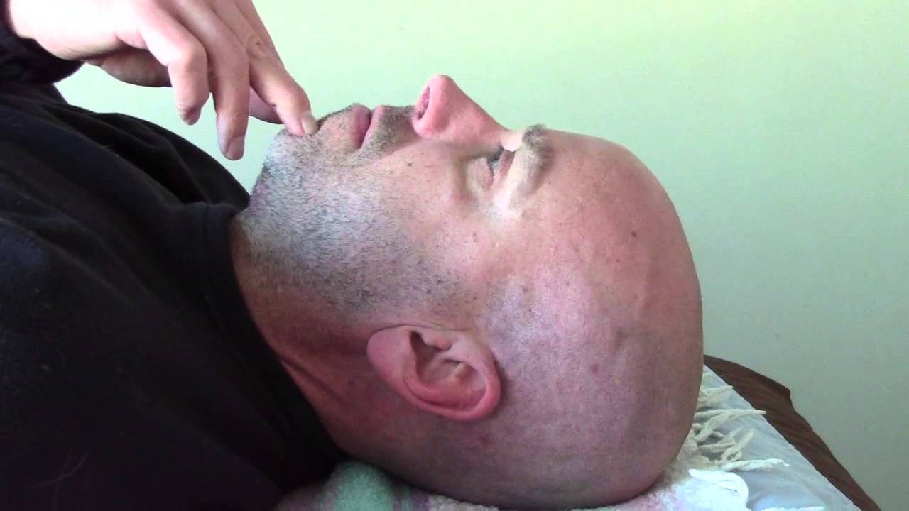 mandibular protrusion - YouTube