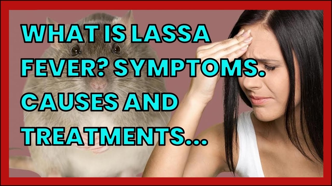 WHAT IS LASSA FEVER? SYMPTOMS. CAUSES AND TREATMENTS AS TWO CASES ...