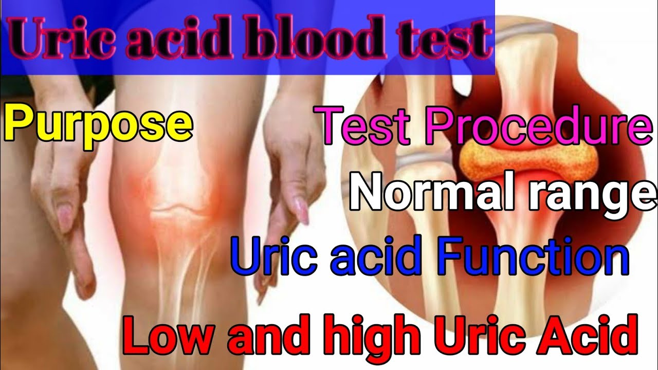 Uric acid or Uricemia Blood test: Normal range: purpose: Procedure ...