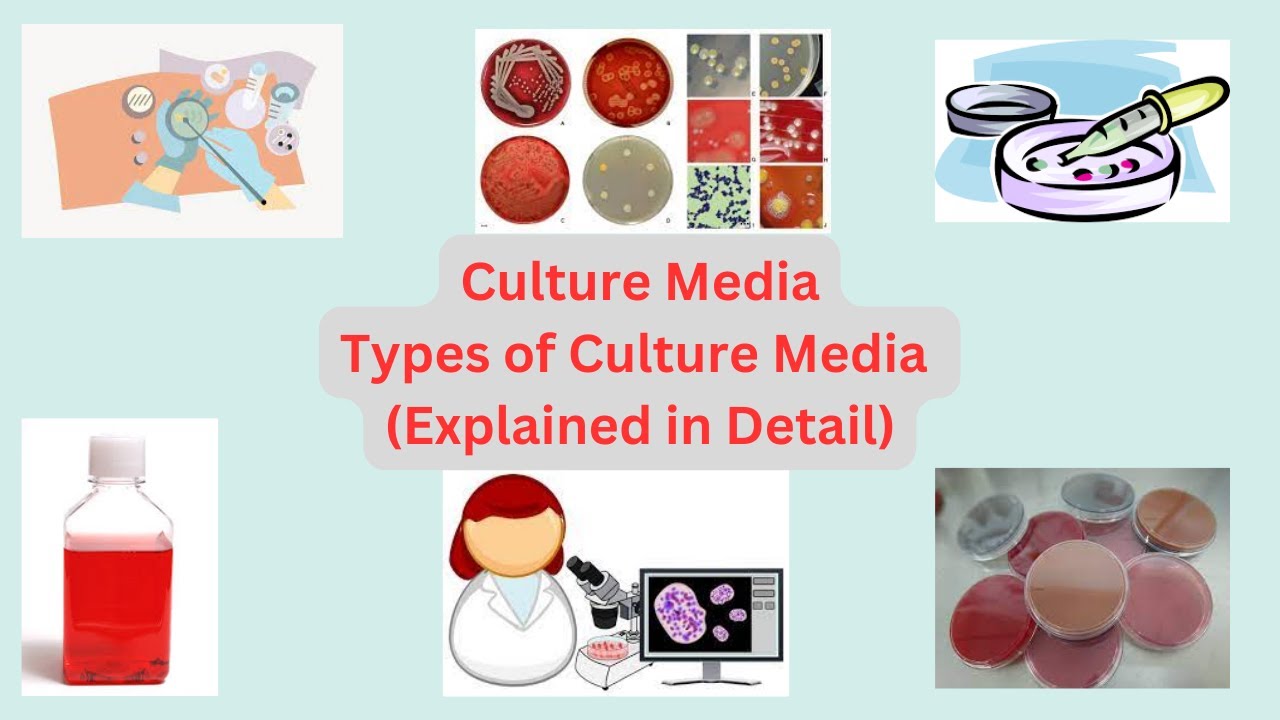 Culture Media Microbiology | Types of culture media Microbiology ...