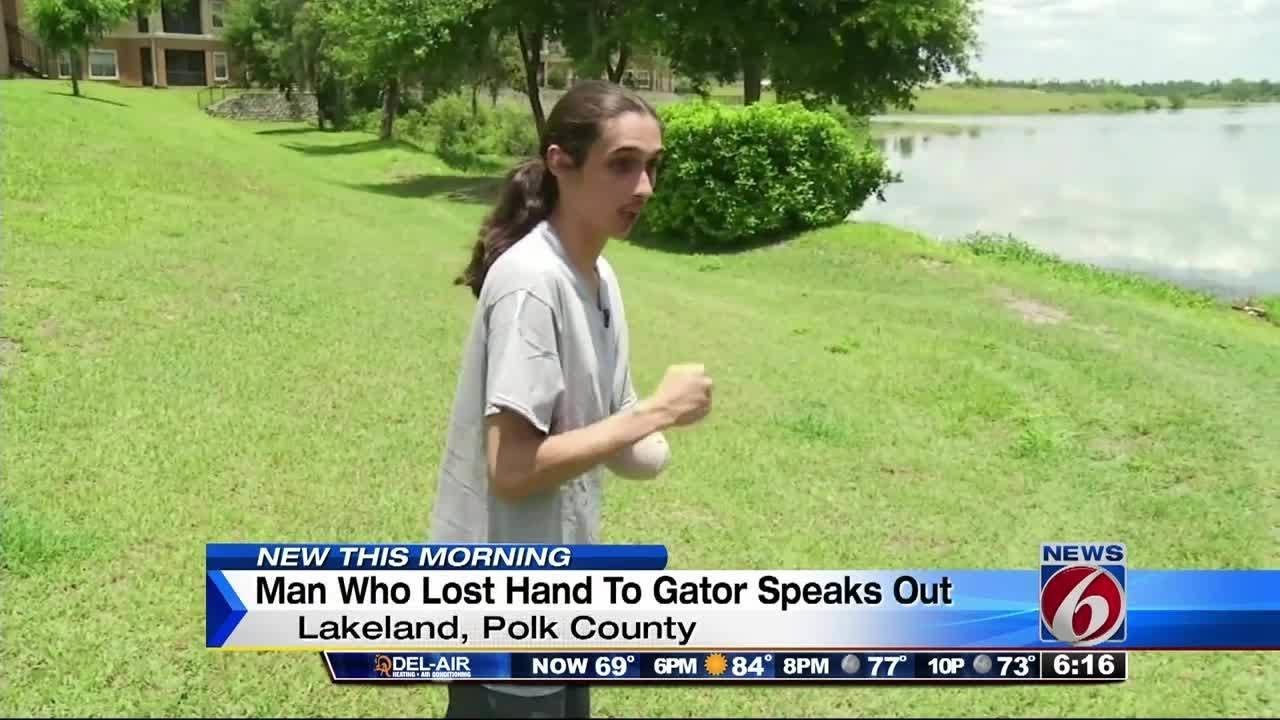 Man who lost arm describes gator attack - YouTube