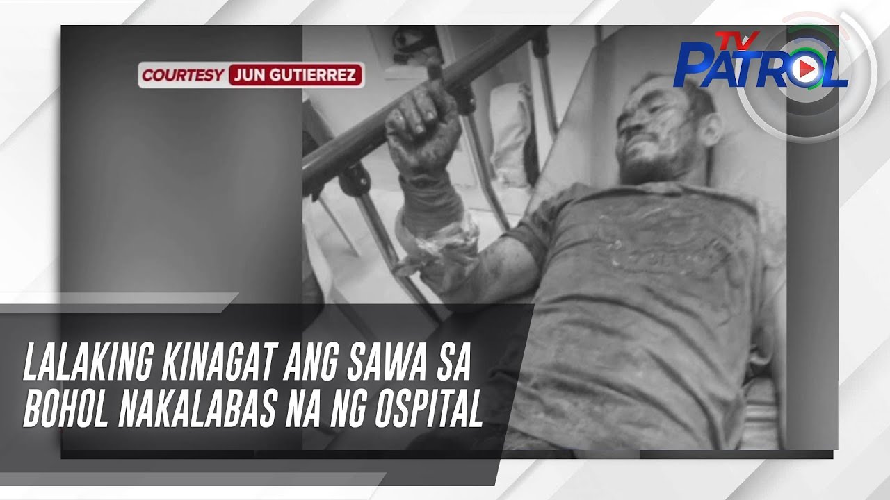 Lalaking kinagat ang sawa sa Bohol nakalabas na ng ospital | TV Patrol ...