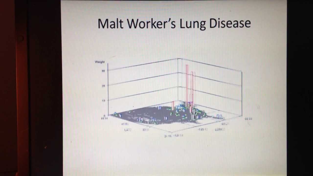 Malt Workers Lung Disease - YouTube