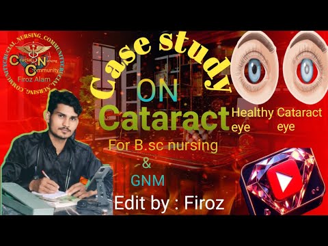 Case study on Cataract ||Normal eye between Cataract eye ...
