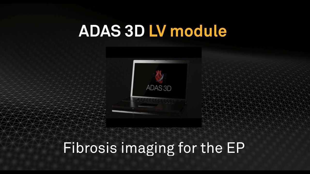 ADAS 3D LV module - YouTube