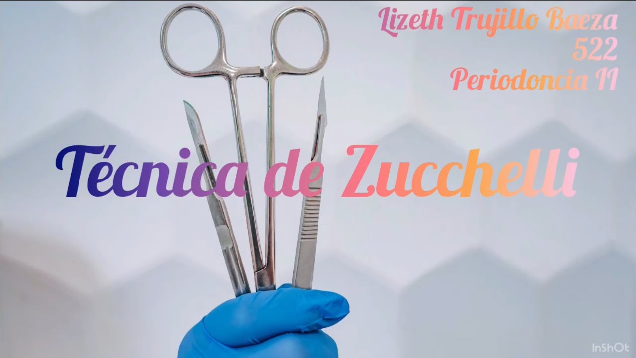 Técnica de Zucchelli || Preclínica Periodoncia II - YouTube