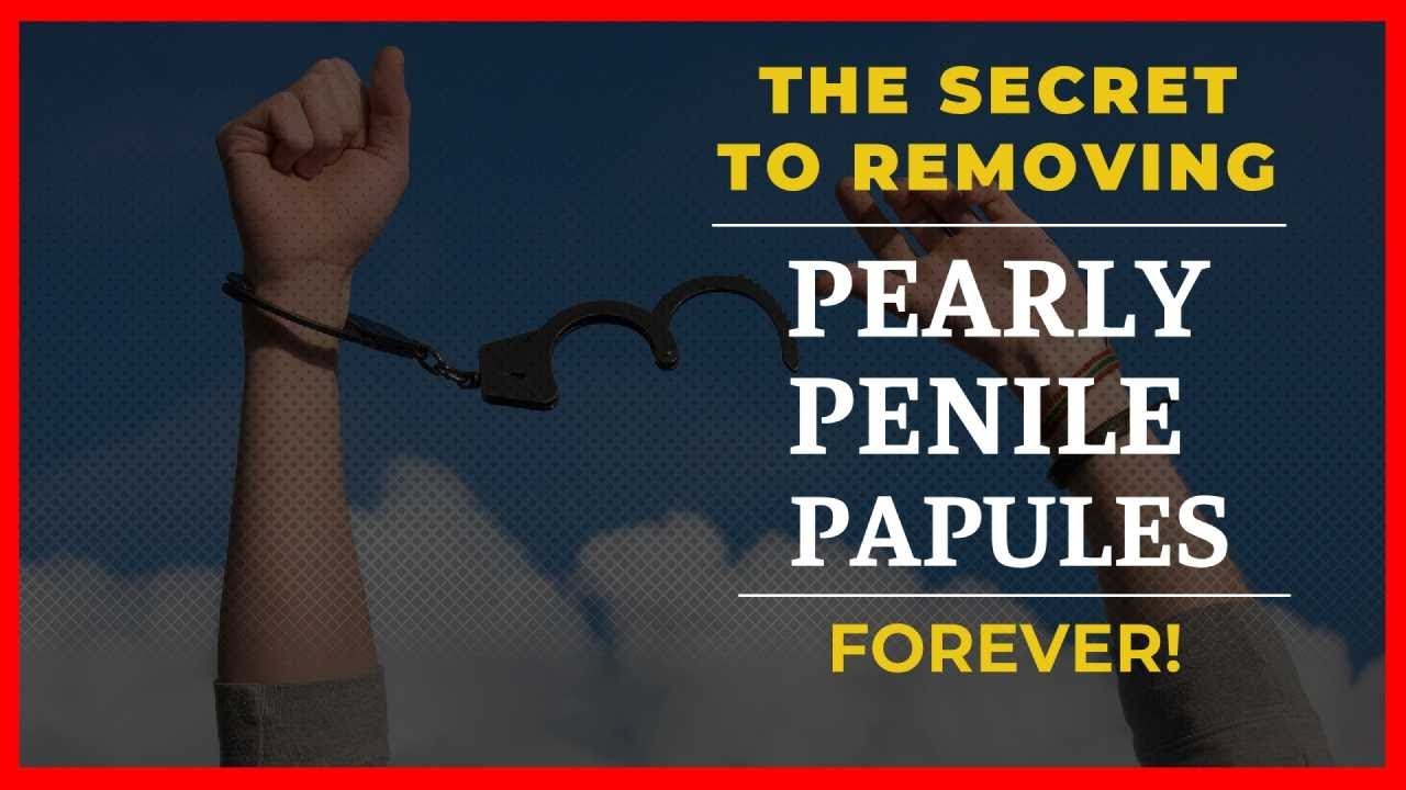 Pearly Penile Papules How To Get Rid | Worry No More! - YouTube