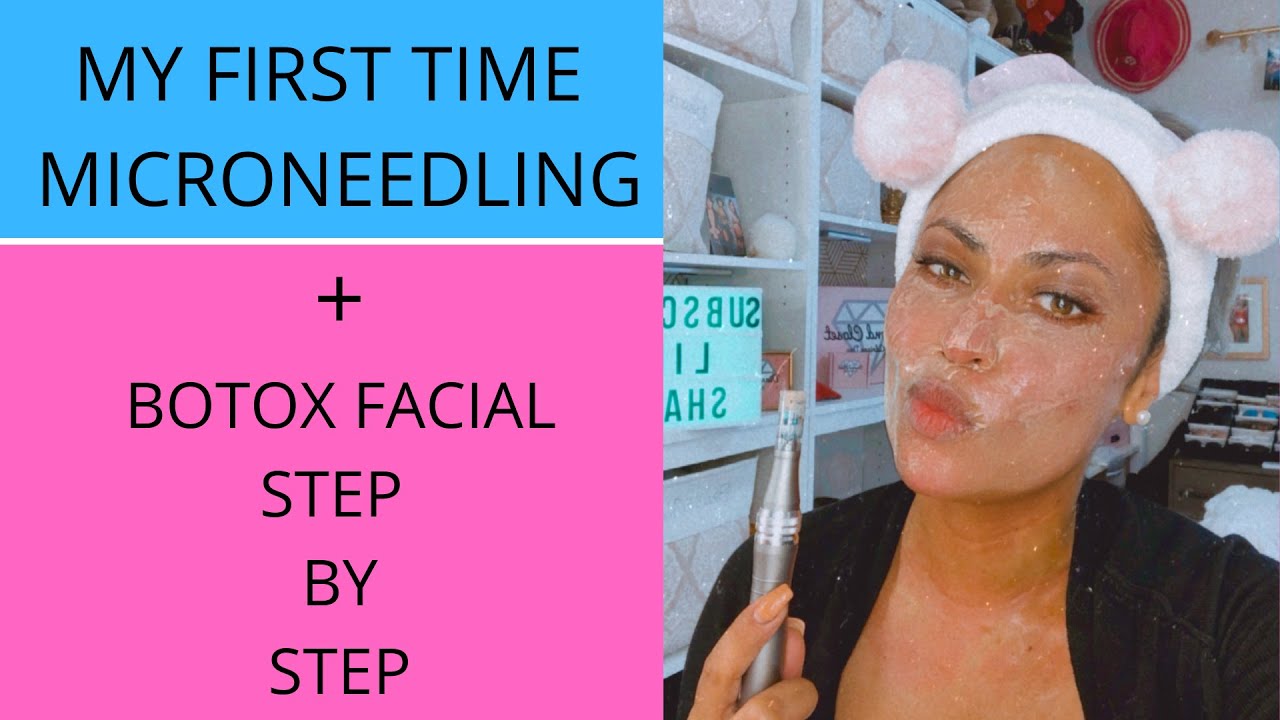 COSMETIC MICRONEEDLING/ + BOTOX FACIAL/ Step by Step - YouTube