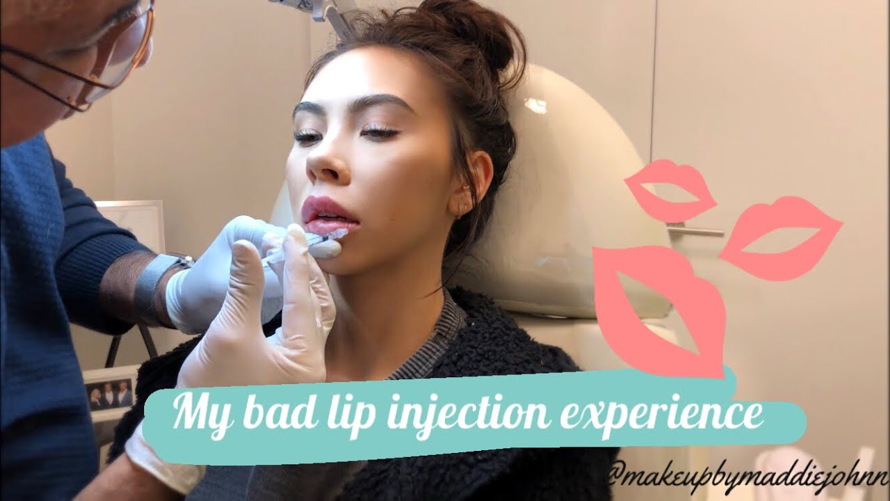 MY BAD LIP INJECTION EXPERIENCE & THE PROCESS OF FIXING THEM. (PART I ...