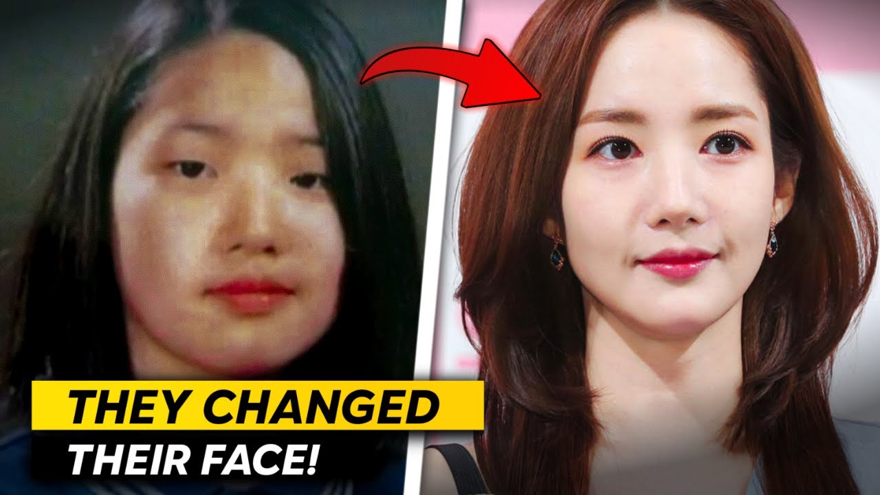 Korean Actors With The Most Crazy Plastic Surgeries - YouTube