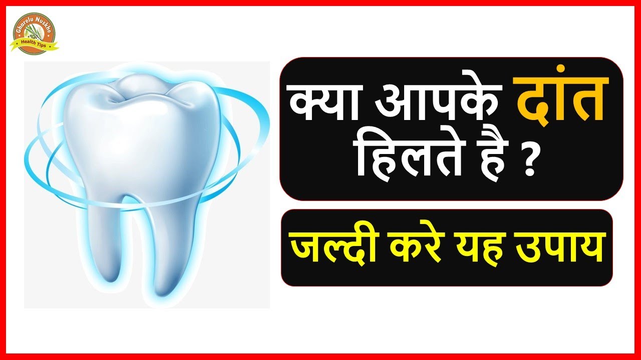 मेरे दांत हिलते है क्या करू? | dant ka hilna ka ilaj | असरदार इलाज ...