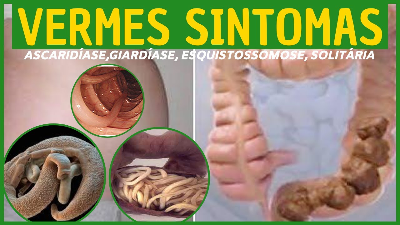 PRINCIPAIS SINTOMAS DE VERMINOSES INTESTINAIS - (SOLITÁRIA ...
