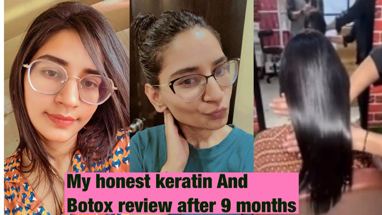 Real Story Behind Botox treatment review post 9 months of Botox| Hair ...