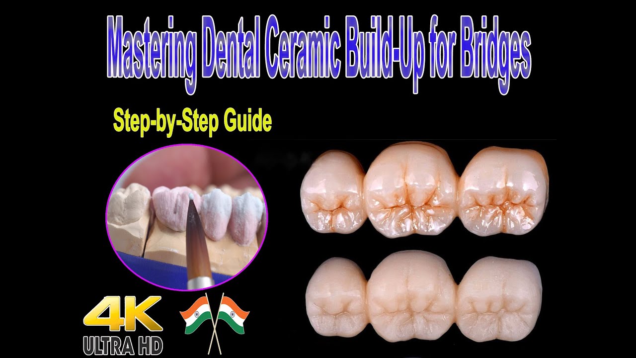 Mastering Dental Ceramic Build-Up for Bridges: Step-by-Step Guide 🦷 ...