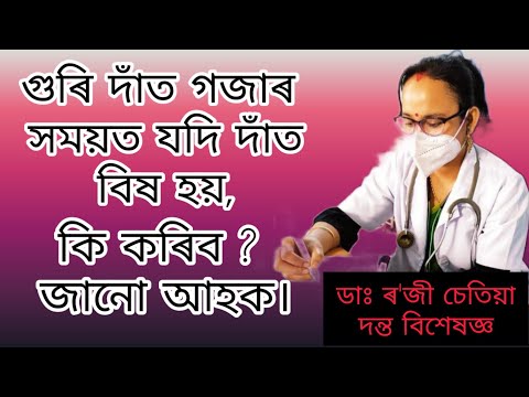গুৰি দাঁত গজাৰ সময়ত যদি দাঁত বিষ হয়,কি কৰিব?//Teeth pain during eruption//Dr.Rosy Borah Chetia