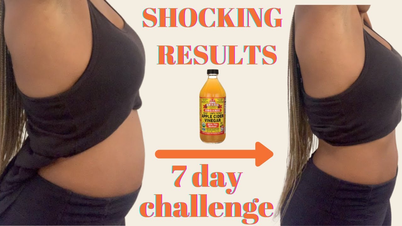 7 DAY ACV Challenge | Drink this to burn BELLY FAT FAST | Health ...