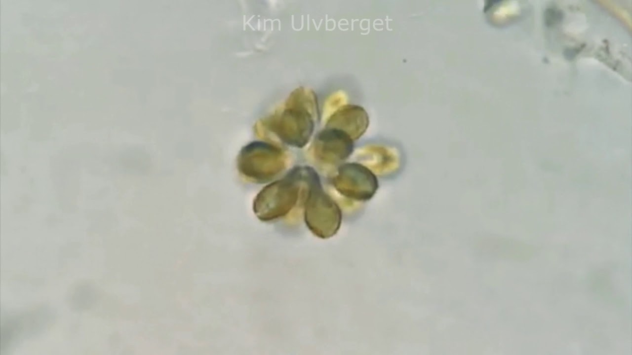 Synura - Golden algae colony under a microscope - eukaryotes - YouTube