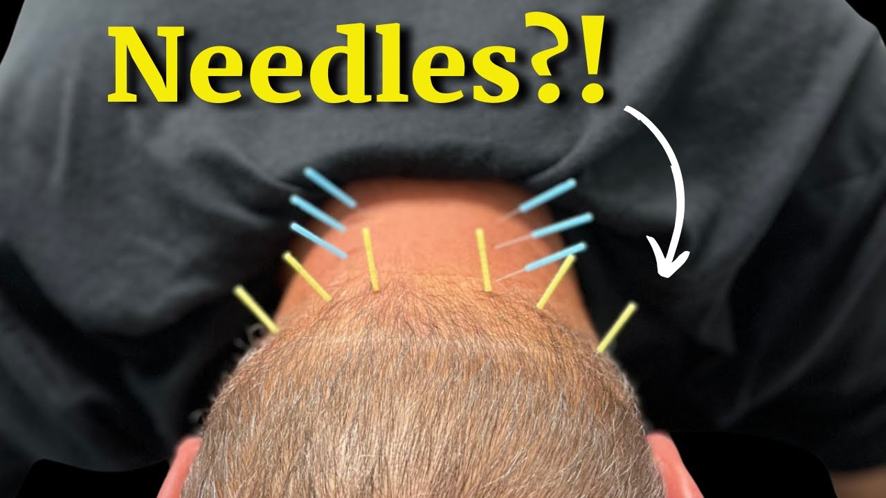 Article Review: Dry Needling for Neck Pain in Combat Athletes - YouTube