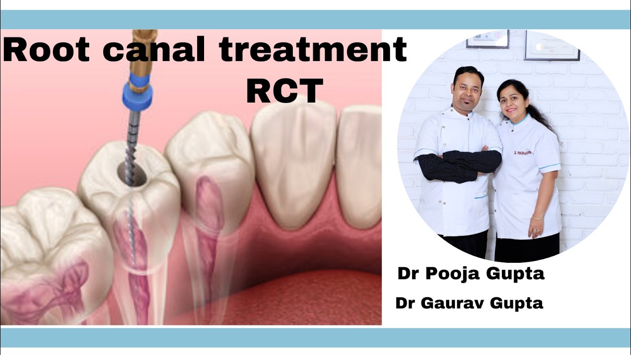 ROOT CANAL Treatment Made SIMPLE Without The CONFUSION - YouTube