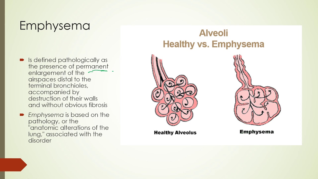 Emphysema - YouTube