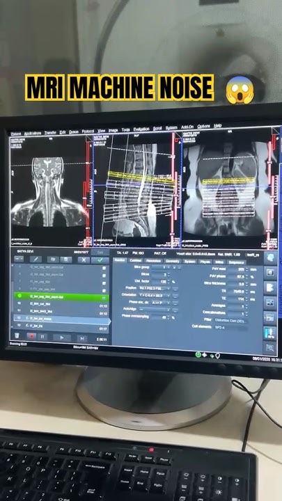 MRI machine noise #radiologycareer #mriscan #mrimachinenoise#trend #viralshort #viralreels# ...