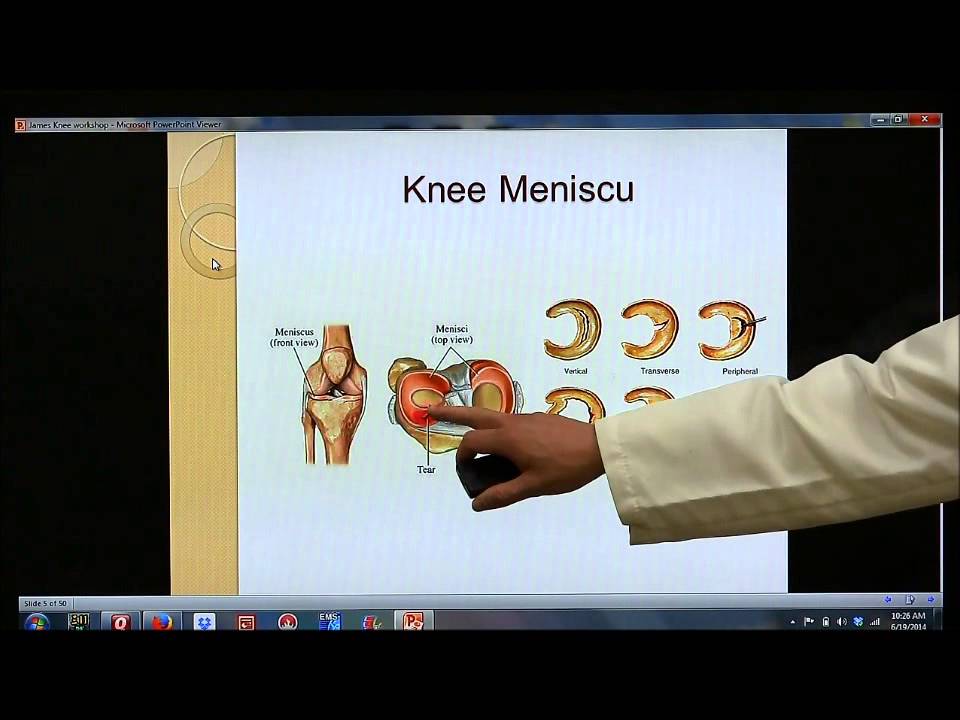 HOLISTIC HEALING | HOW TO TREAT KNEE PAIN NATURALLY (CHINESE) - YouTube