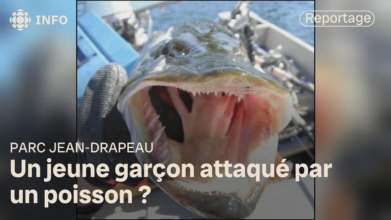 Un jeune garçon transporté à l’hôpital après une morsure de poisson à ...