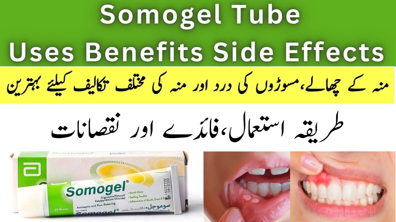 Somogel Use In Urdu | Somogel For Mouth Ulcer | Sumo Gel Lagane Ka ...