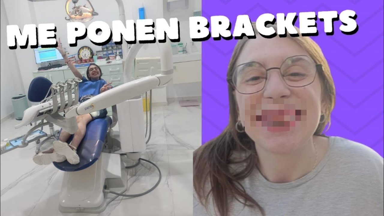 ME PONEN BRACKETS - YouTube