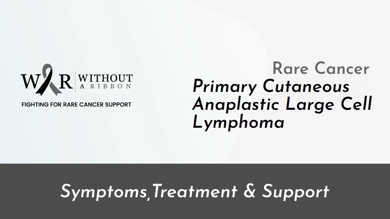 PRIMARY CUTANEOUS ANAPLASTIC LARGE CELL LYMPHOMA - YouTube