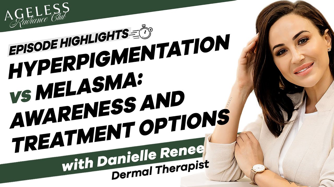 Hyperpigmentation vs Melasma: Awareness and Treatment Options with ...