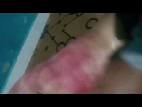 KEROKAN SAKIT SEKALEEEE