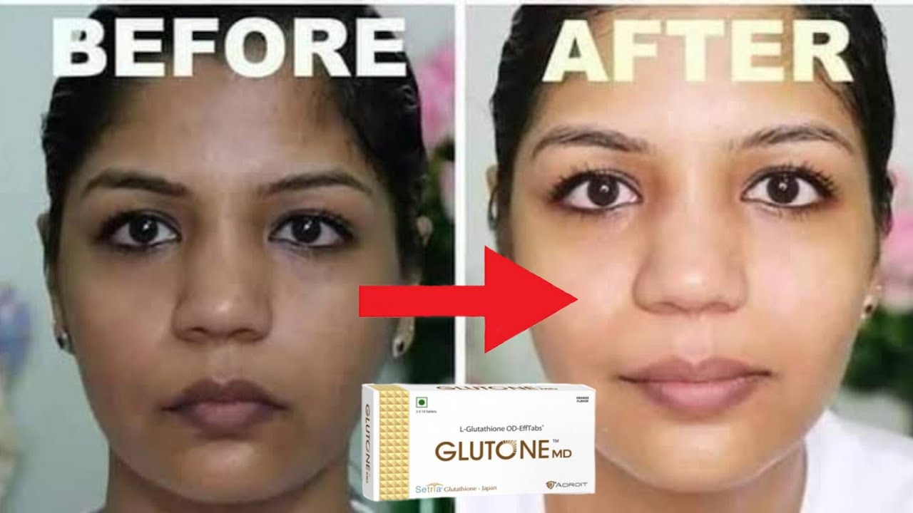 Glutone MD Review | Skin whitening tablet | Glutathione Benefits - YouTube