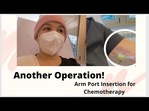 Another Operation! Arm Port Insertion /Life of a CancerFighter Ep.2 # ...