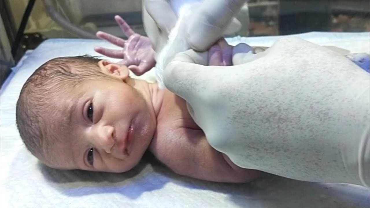 Newborn Baby Suction Procedure in NICU | How to Safely Remove Mucus# ...