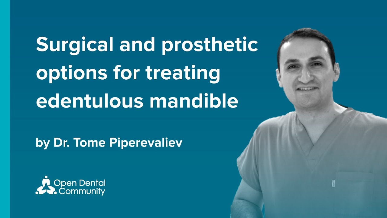 Webinar: Surgical and prosthetic options for treating endentolous ...