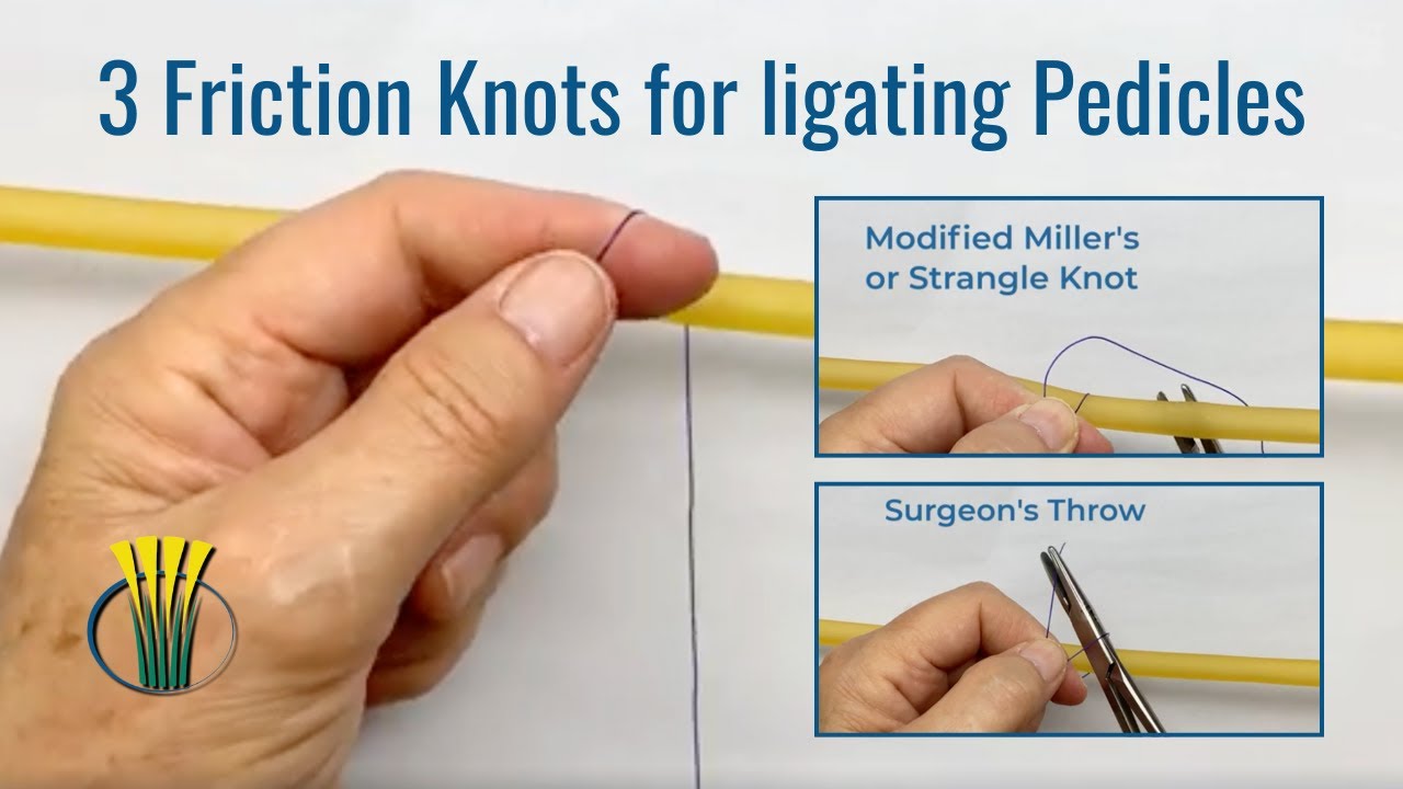 3 Friction Knots for ligating Pedicles - YouTube