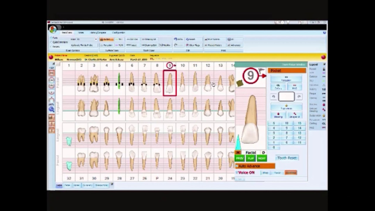 DenChart Perio Charting Demo YouTube DenChart Perio Charting Demo YouTube