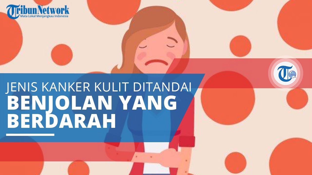 Karsinoma Sel Basal, Jenis Kanker Kulit Ditandai dengan Kemunculan ...