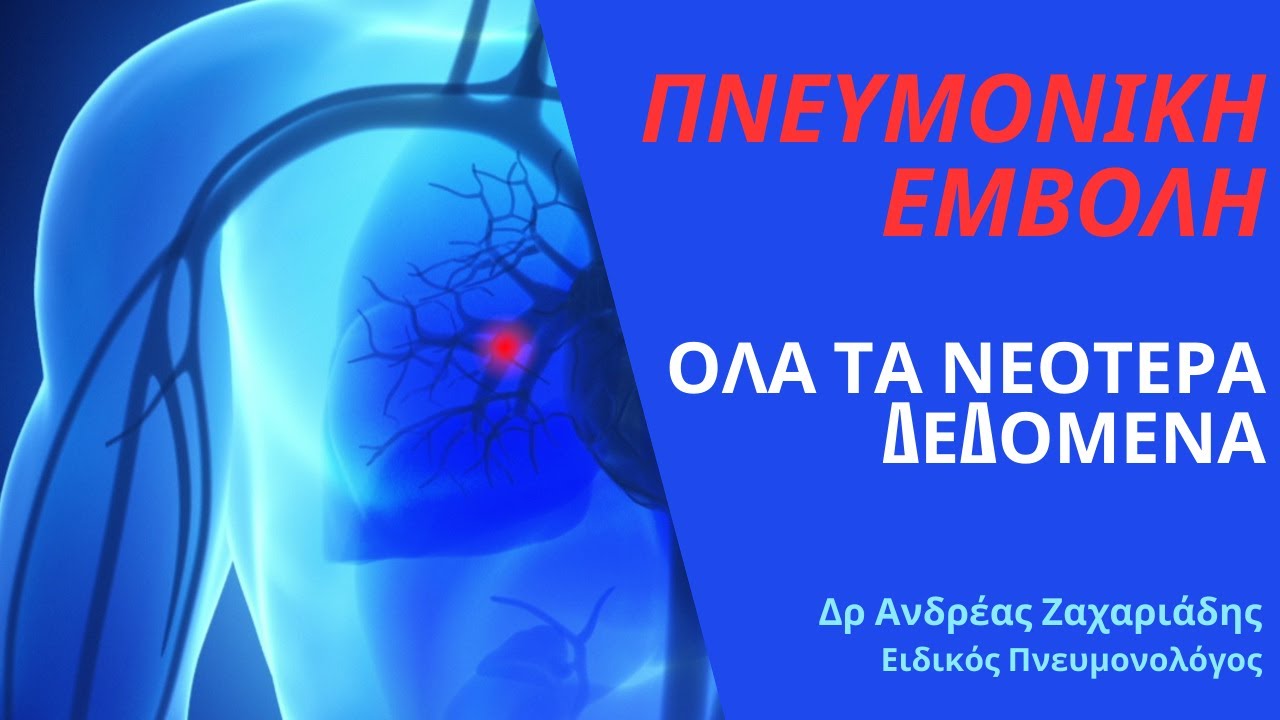 Πνευμονική εμβολή - YouTube
