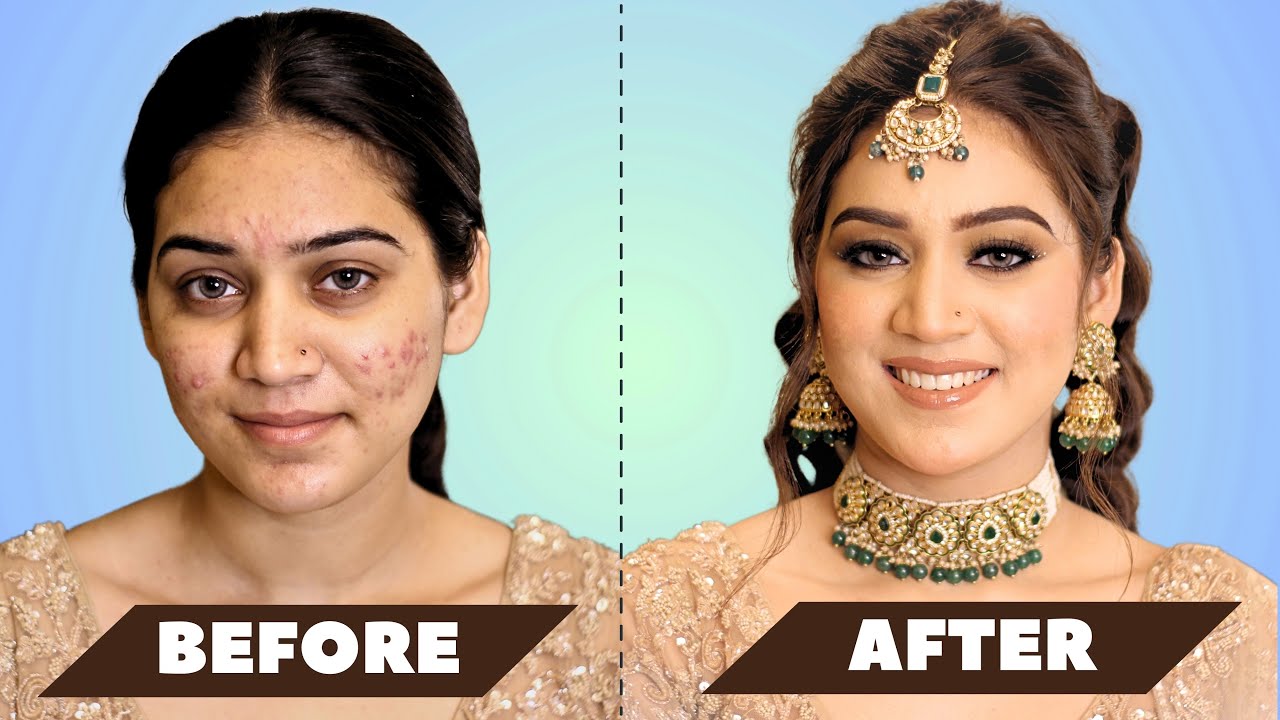Acne-Prone Skin पर Flawless Makeup | Best Tips for Clear & Smooth Look ...