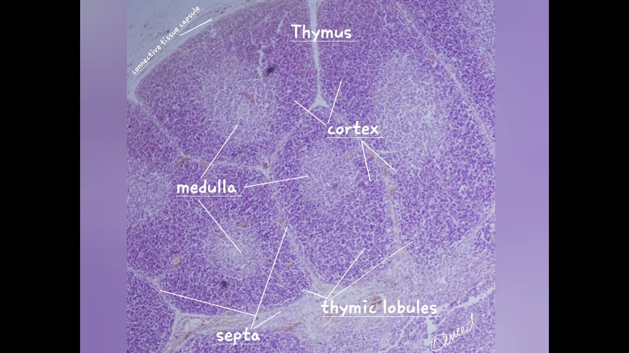 Thymus Gland Slide Labeled