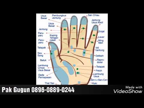 Terapi Aktivasi Syaraf Telapak Tangan di Bandung Mencegah Diabetes ...