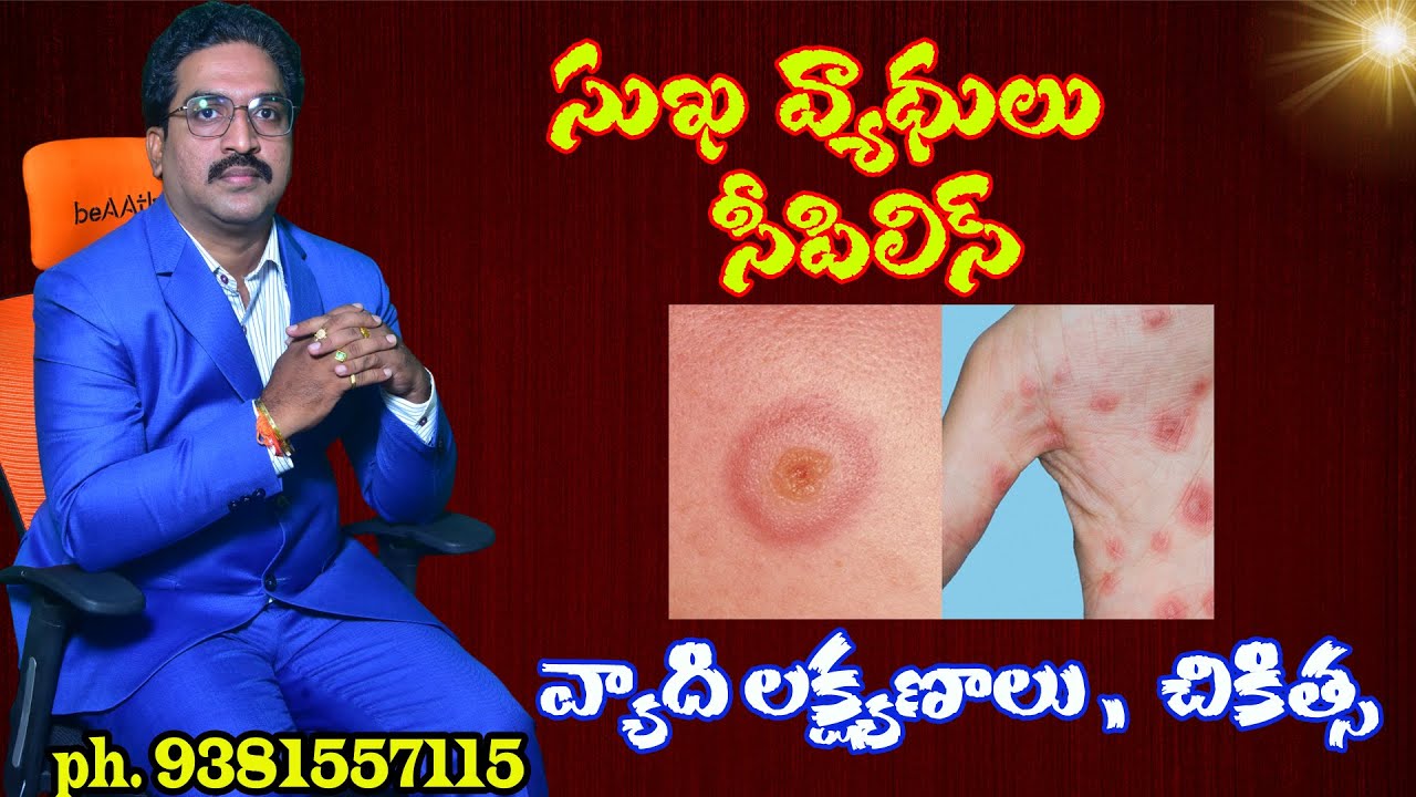 Syphilis| Causes,& Treatment| సుఖవ్యాధులు సిఫిలిస్ | hiv| Syphilis ...