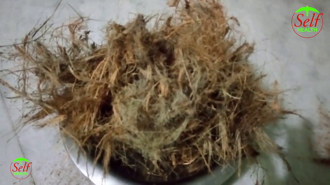 Piles treatment at home - YouTube