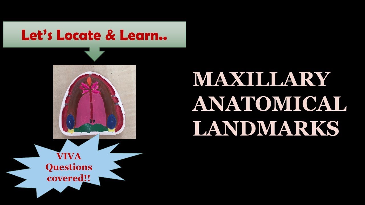MAXILLARY ANATOMICAL LANDMARKS / MARKING ON MODEL / DENTURE BEARING ...