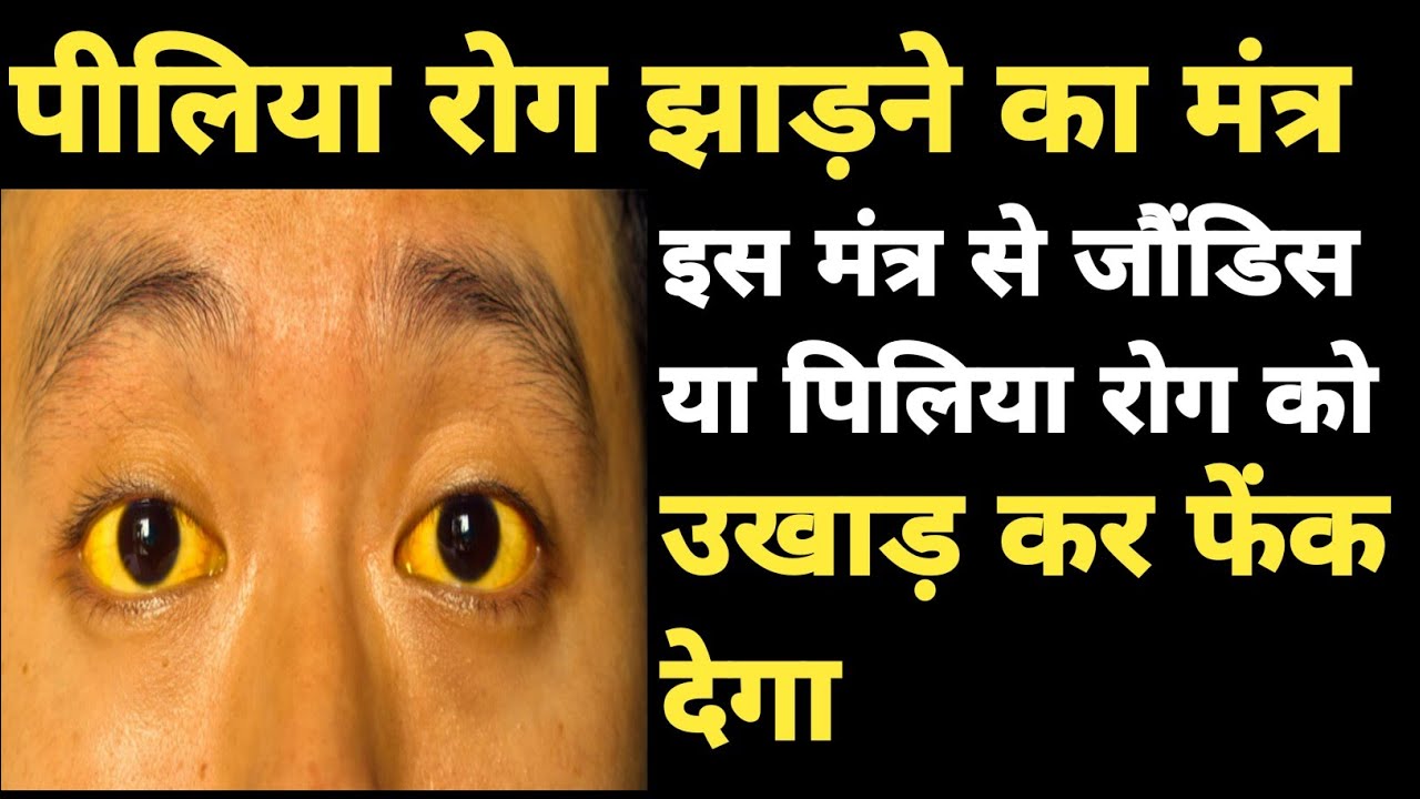 piliya Rog jharane ka Mantra, jaundice Rog ka ilaaj, mahabigha - YouTube