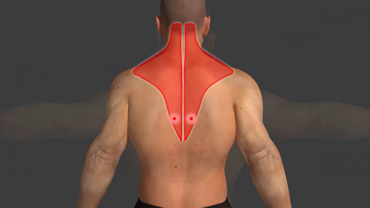trigger point explained with animation - YouTube