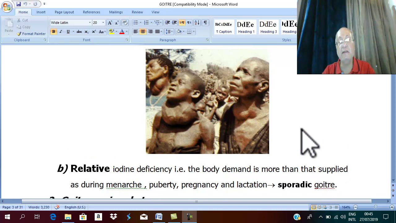 Thyroid disorders in English 4 (Physiological goiter , part 1 ) , by Dr ...