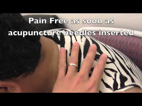 Discover how can Dr Tan Balance Acupuncture Immediate Reduce Neck Pain ...